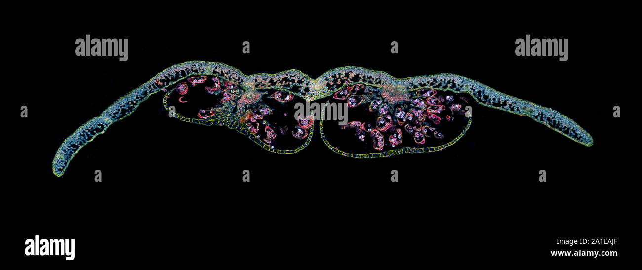 Fern Sori Microscope