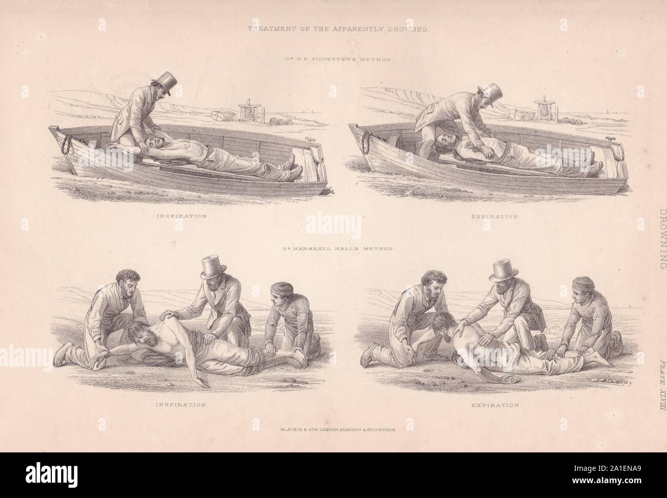 Dr marshall halls method hi-res stock photography and images - Alamy