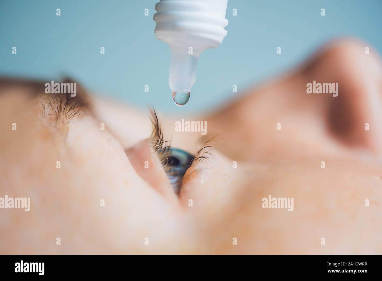 Closeup of eyedropper putting liquid into open eye Stock Photo - Alamy