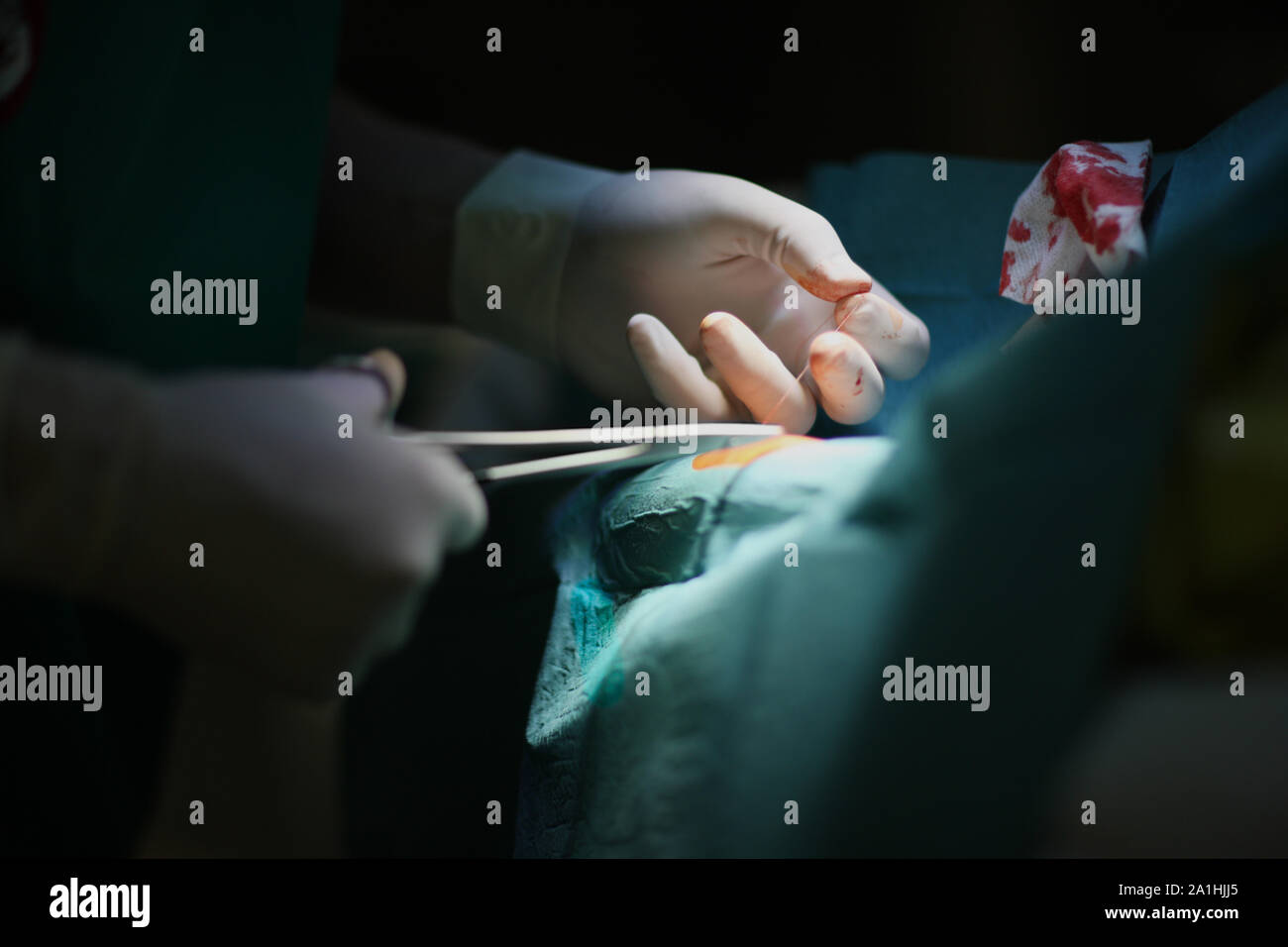 Doctor needle thread hi-res stock photography and images - Alamy