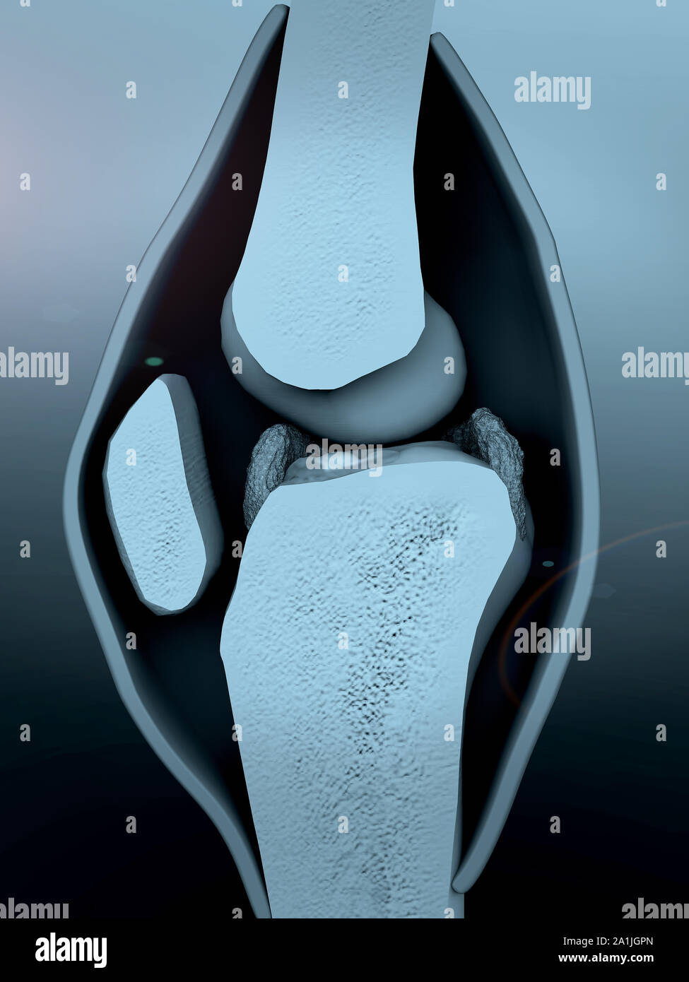 knee, 3d rendered knee illustration, pain illustration knee side, 3d ...