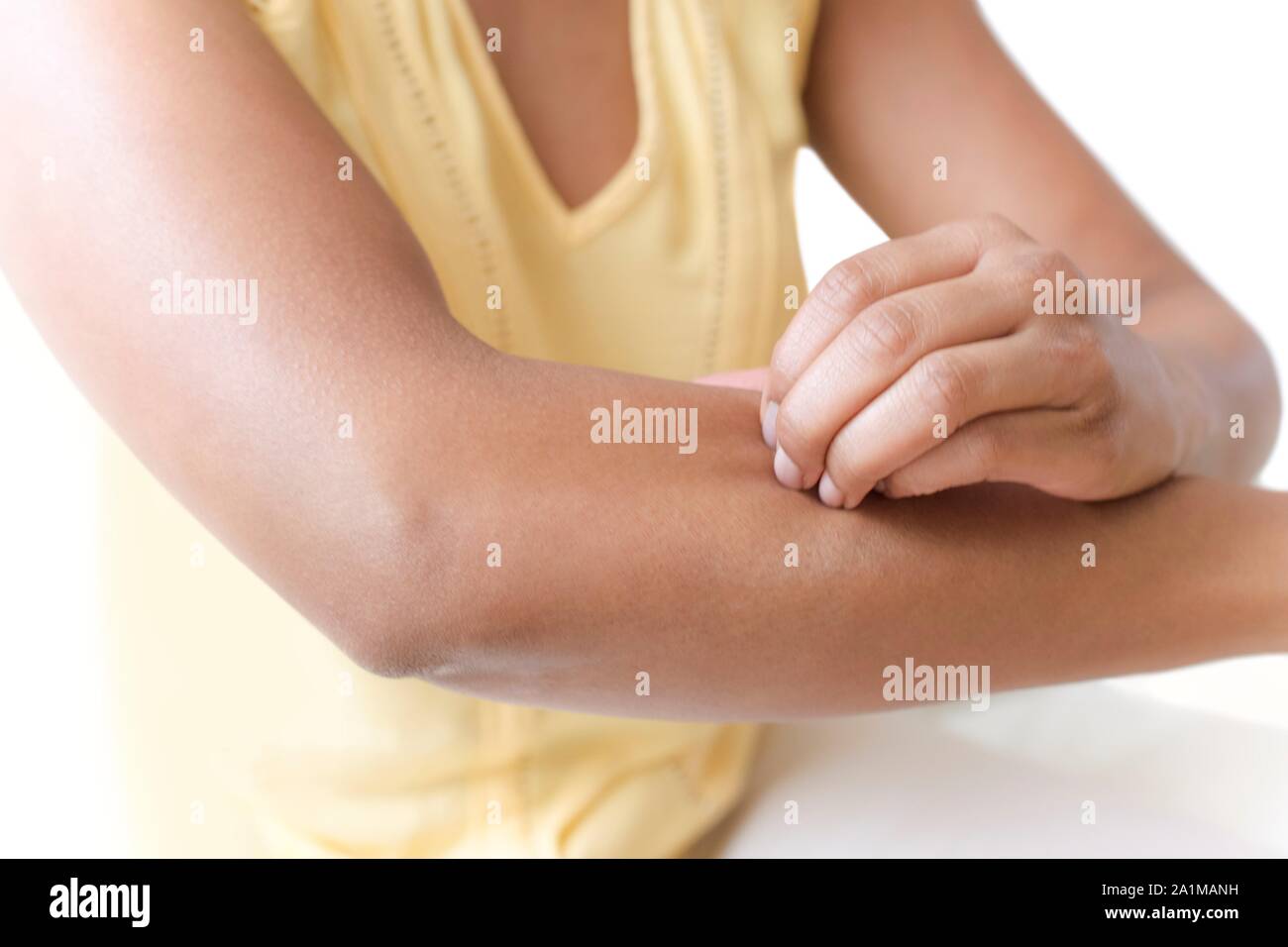Woman scratching her arm Stock Photo - Alamy