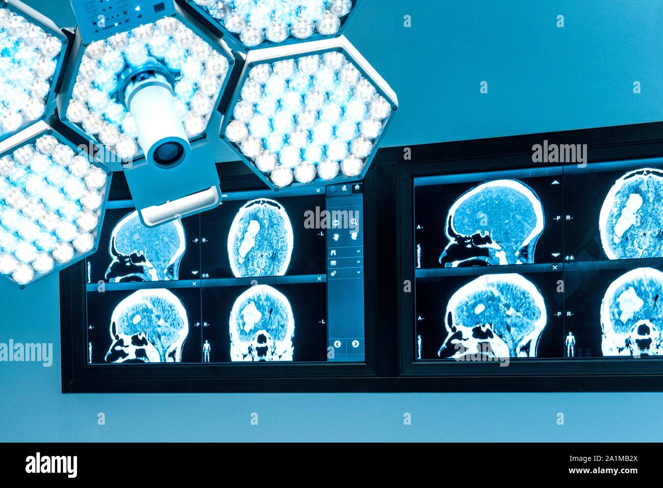 Surgical light and monitors showing magnetic resonance imaging (MRI ...