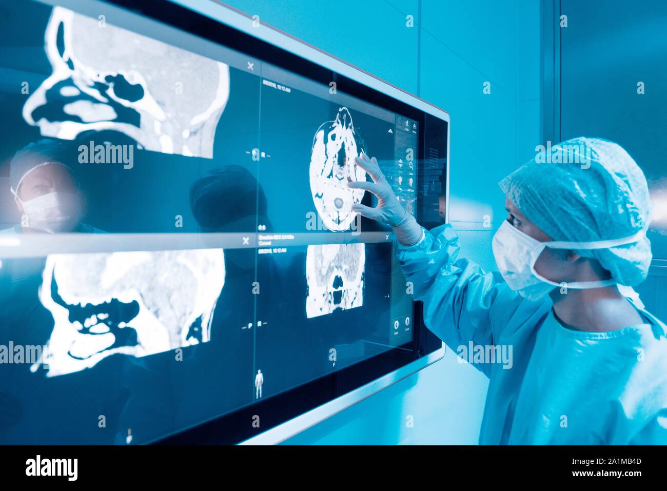 Surgeon looking magnetic resonance imaging (MRI) brains scans during ...