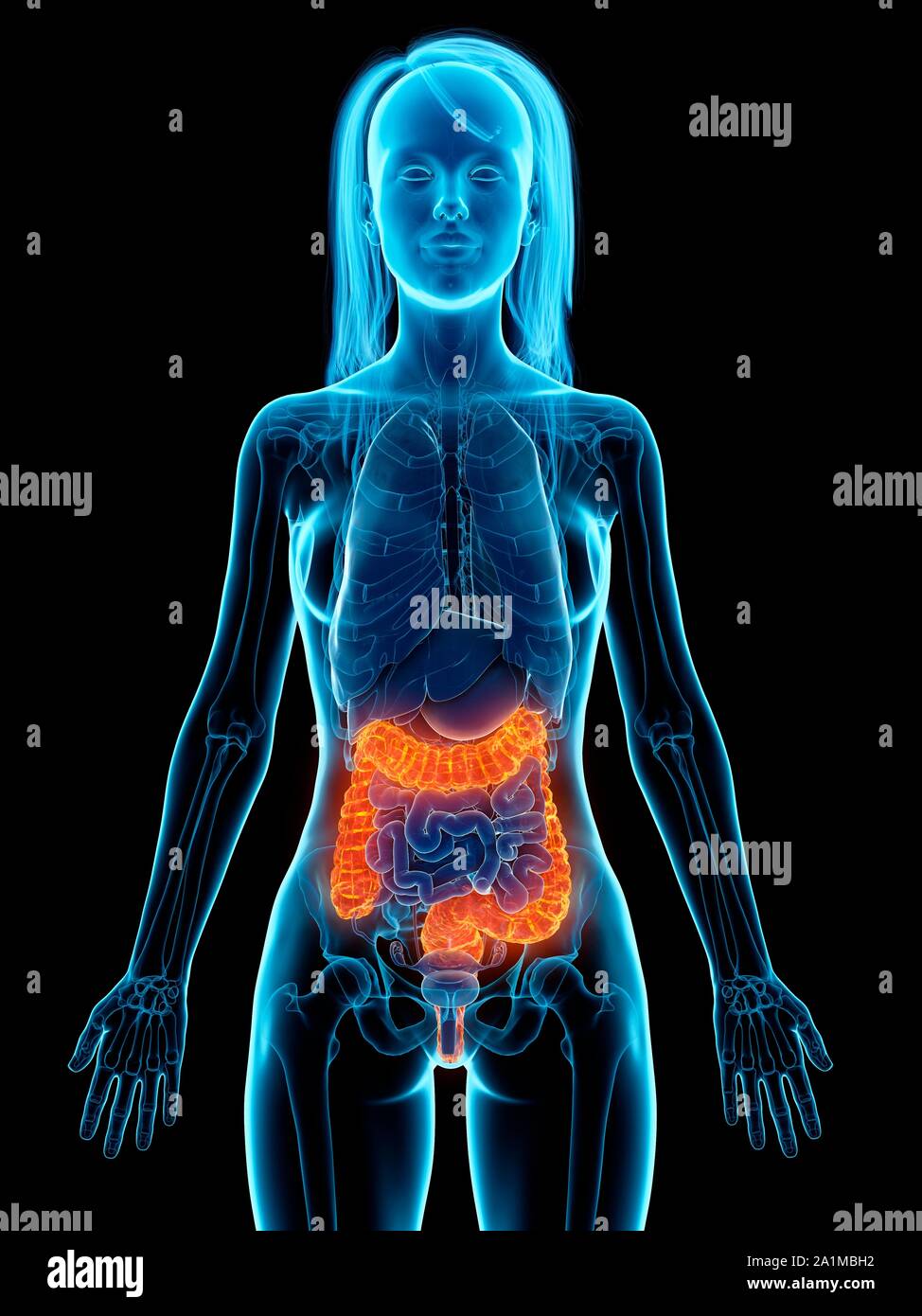Inside unhealthy colon hi-res stock photography and images - Alamy