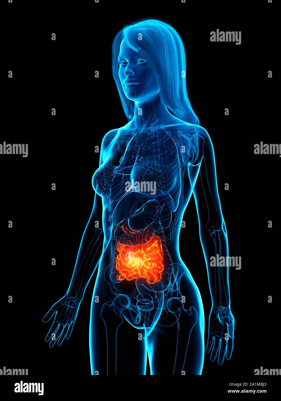 Diseased small intestine, computer illustration Stock Photo - Alamy