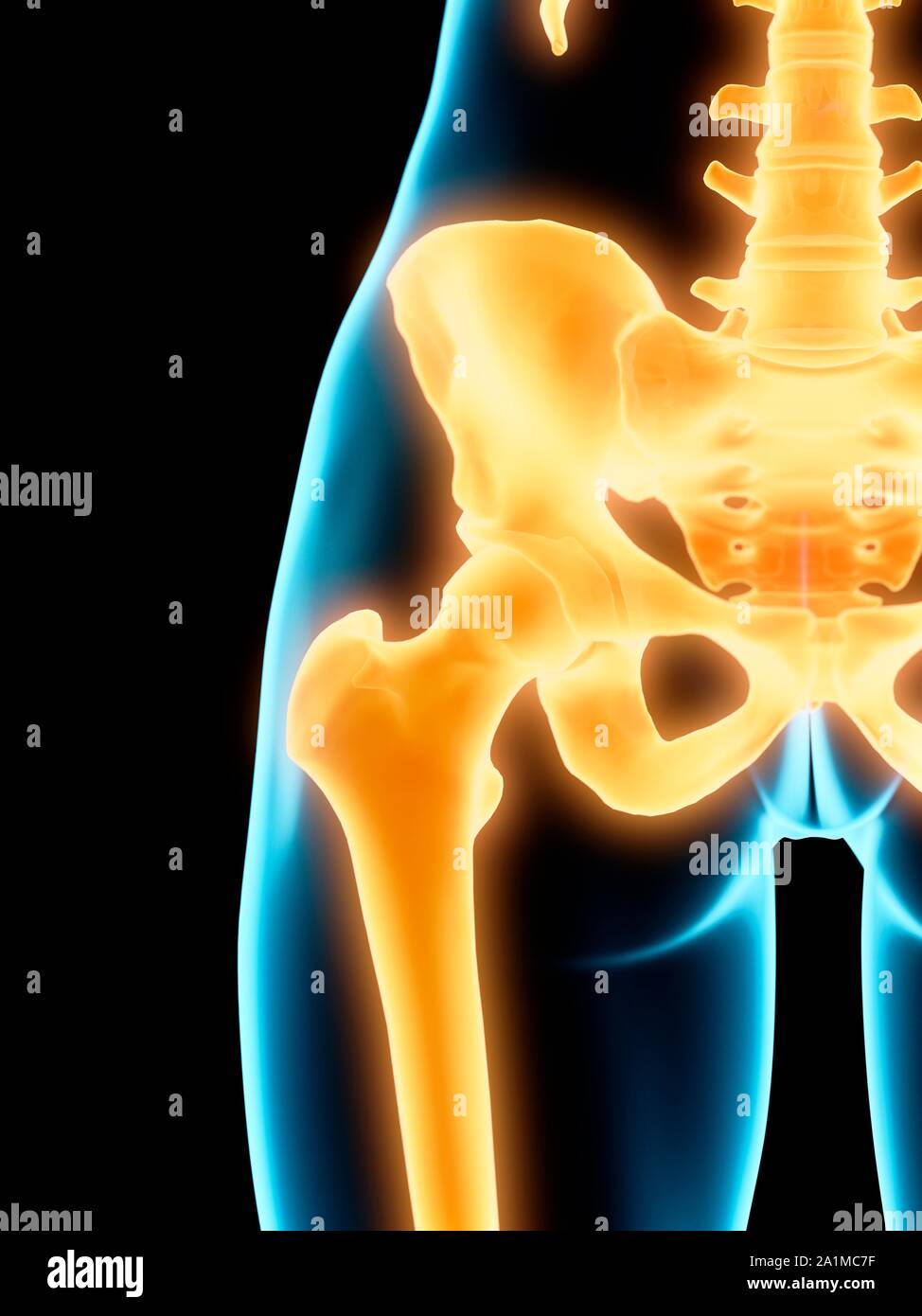 Hip joint, computer illustration Stock Photo - Alamy