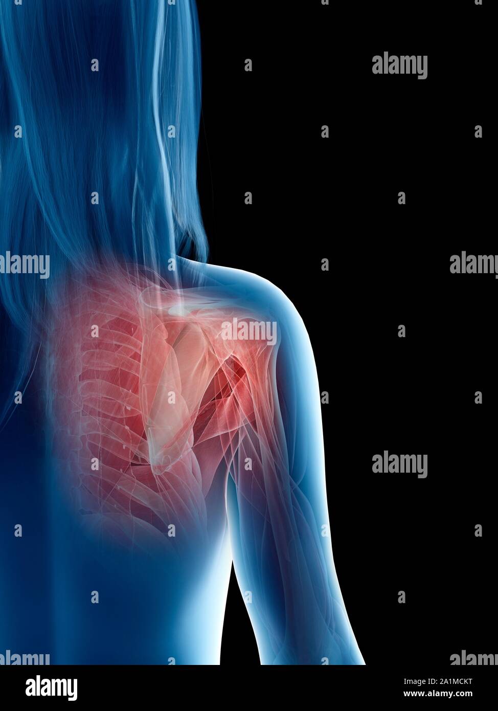 Shoulder muscles, computer illustration Stock Photo - Alamy