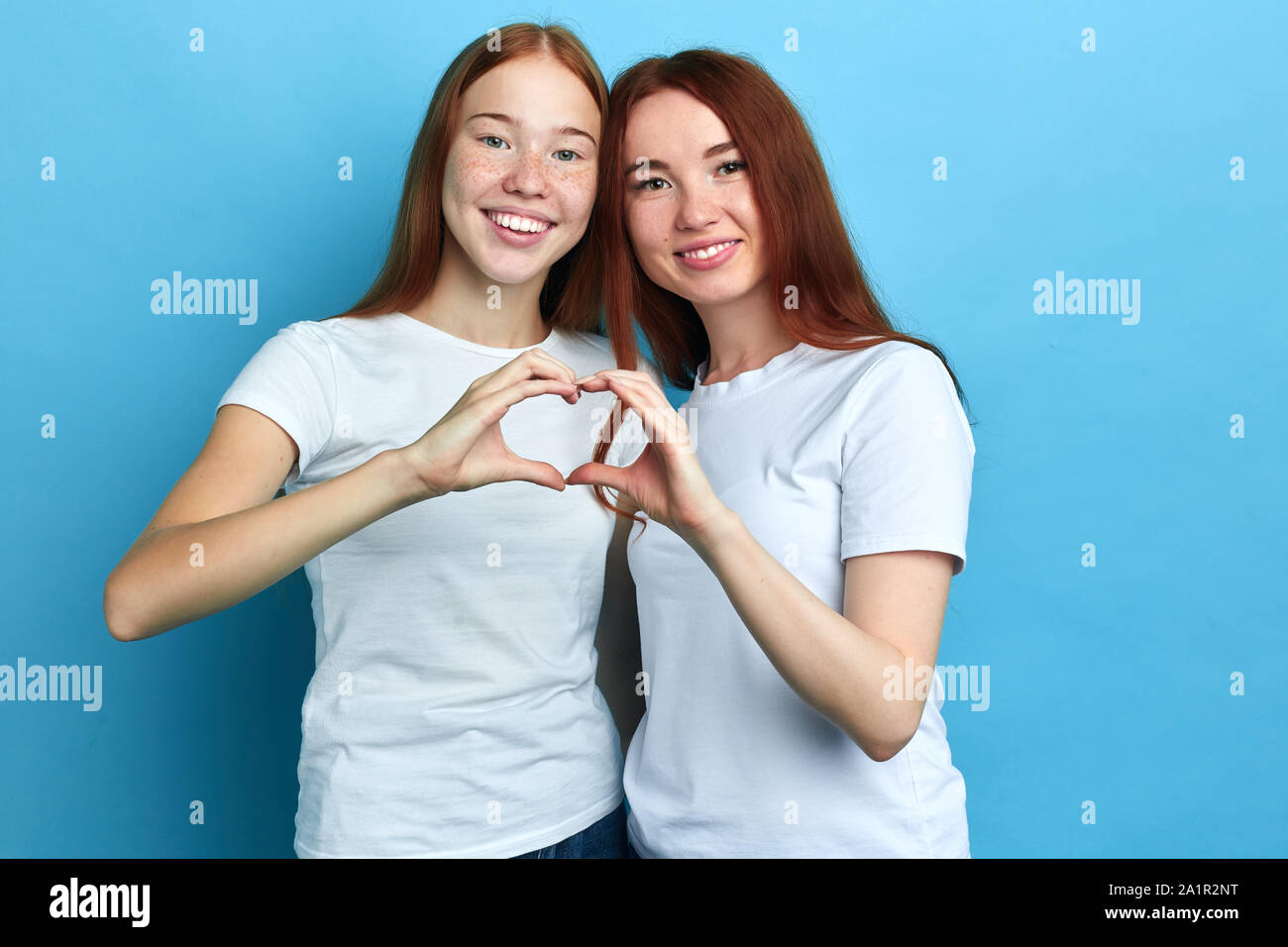 two best friends showing their warm tender feeling, friendship ...