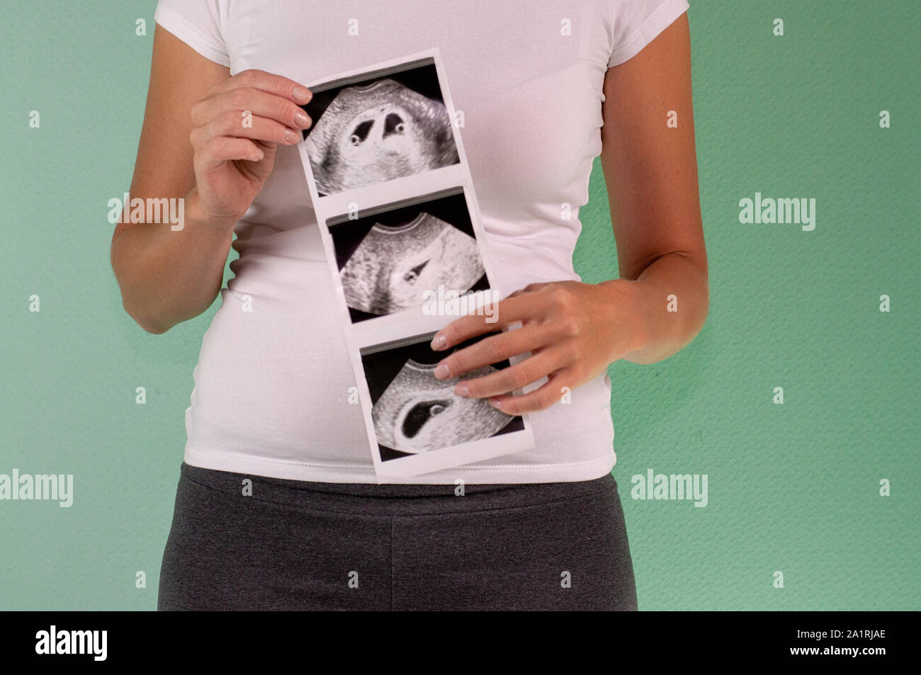 The girl is holding a snapshot of an ultrasound twin in the fourth week ...