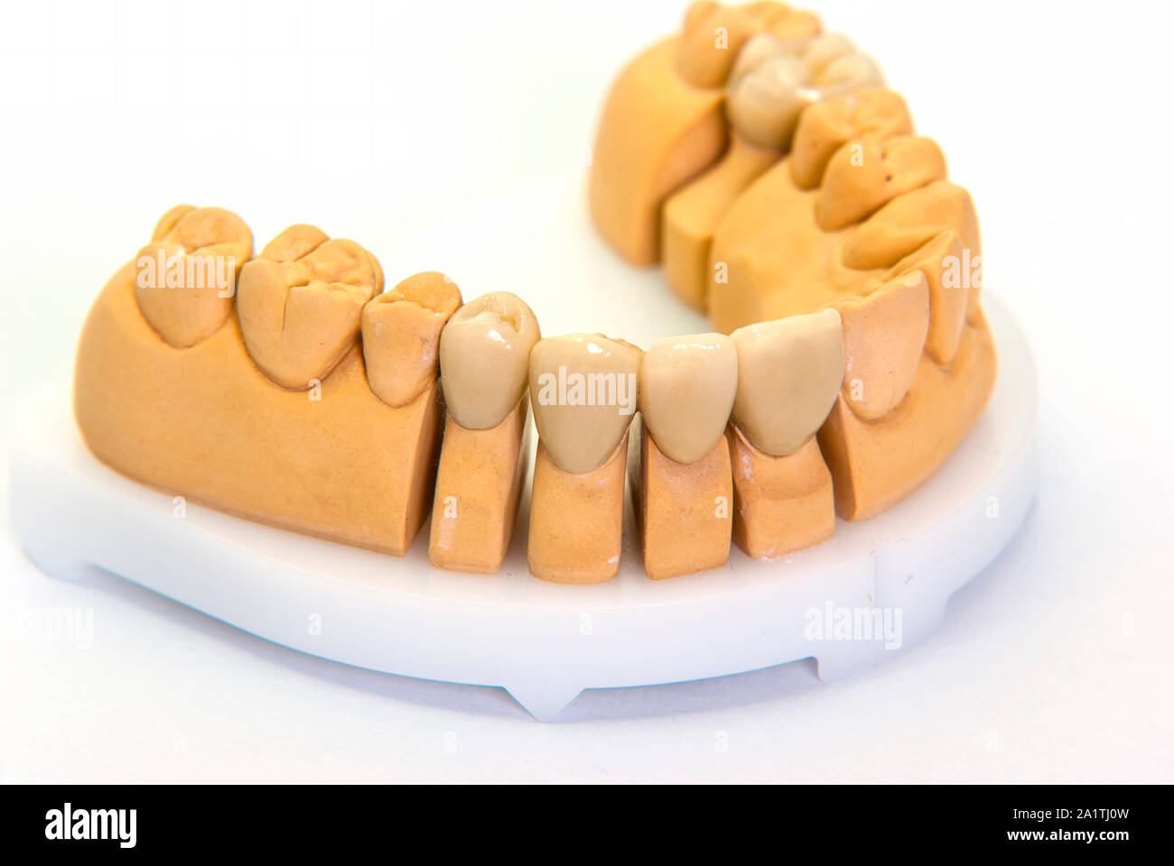 Porcelain teeth on the model in the dentistry lab Stock Photo - Alamy