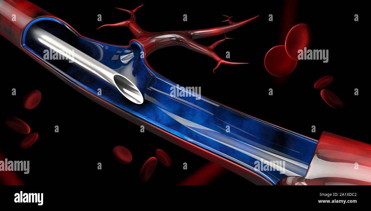 3d Illustration of Injection in the vein on black background Stock ...