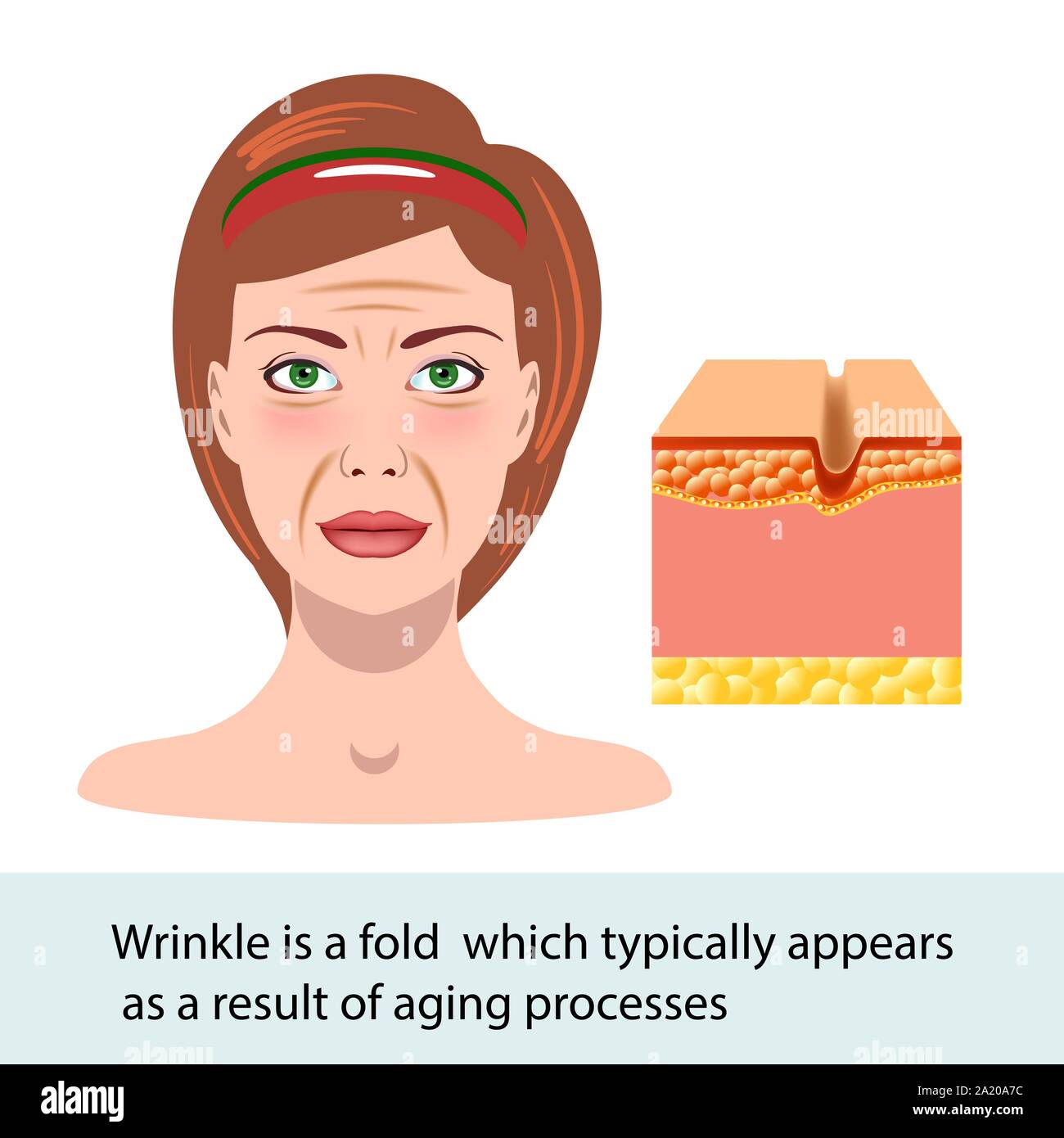 infographic skin illustration. Wrinkle, change of the face, vector ...
