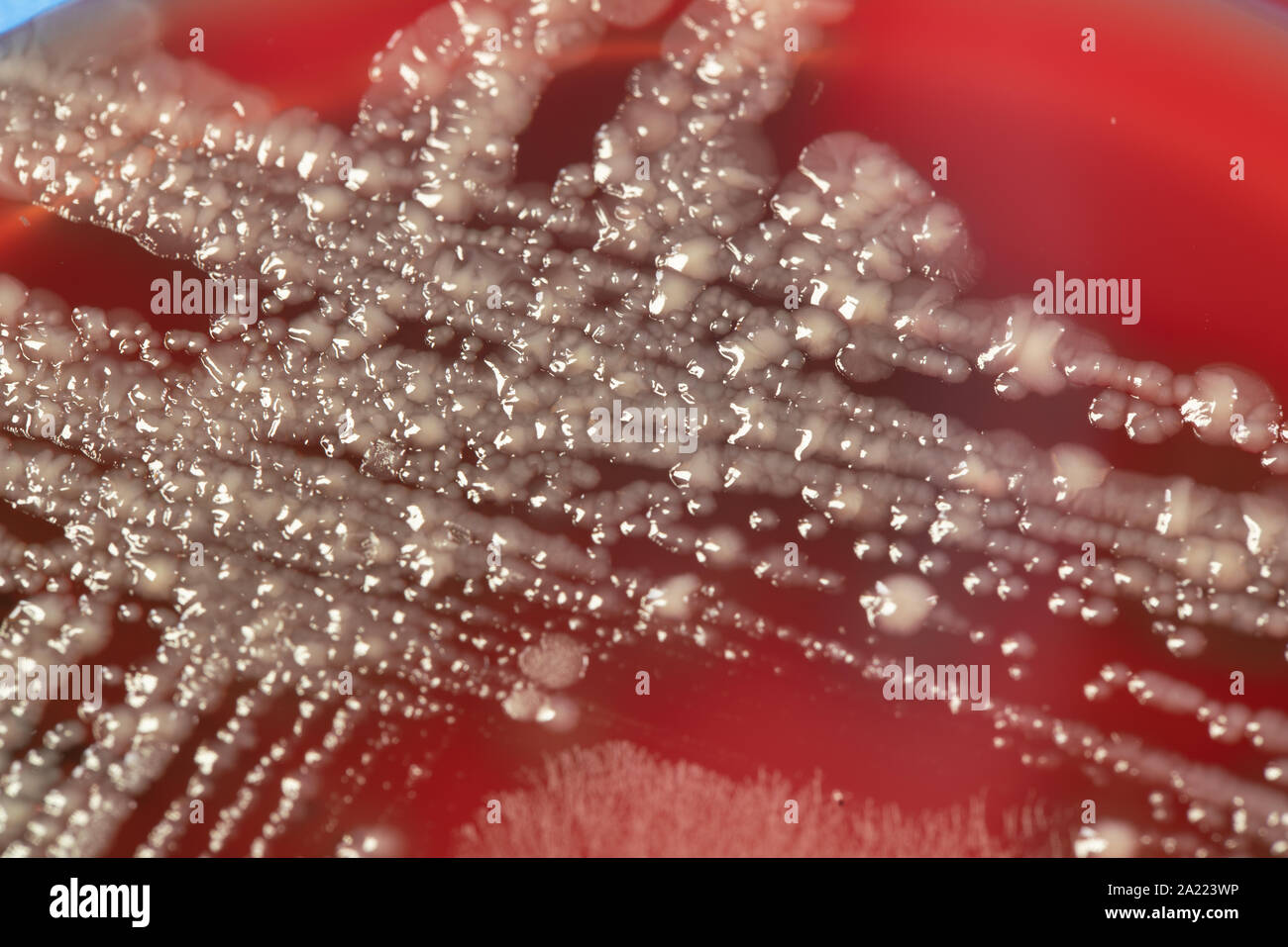 Sowing human feces in a petri dish Stock Photo - Alamy