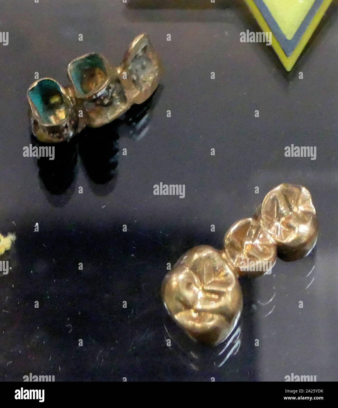 Gold Crown Tooth Holocaust