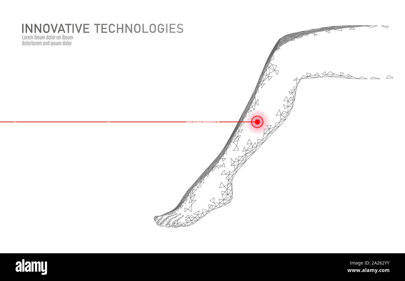 Laser depilation woman leg Cut Out Stock Images & Pictures - Alamy