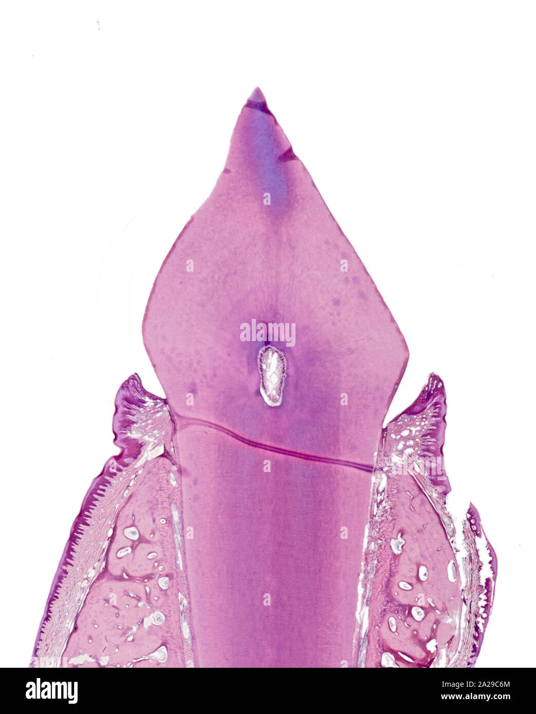 Human incisor tooth in gum, vertical section, brightfield ...