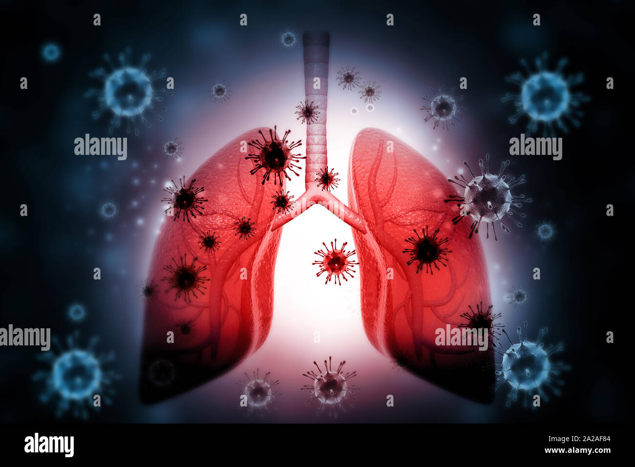 Lungs disease with virus ,bacteria. Medical background. 3d illustration ...