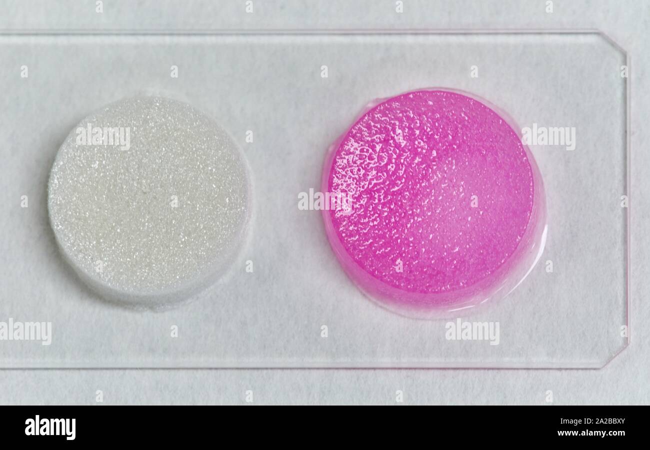 Skin Healing Stock Photos & Skin Healing Stock Images - Alamy