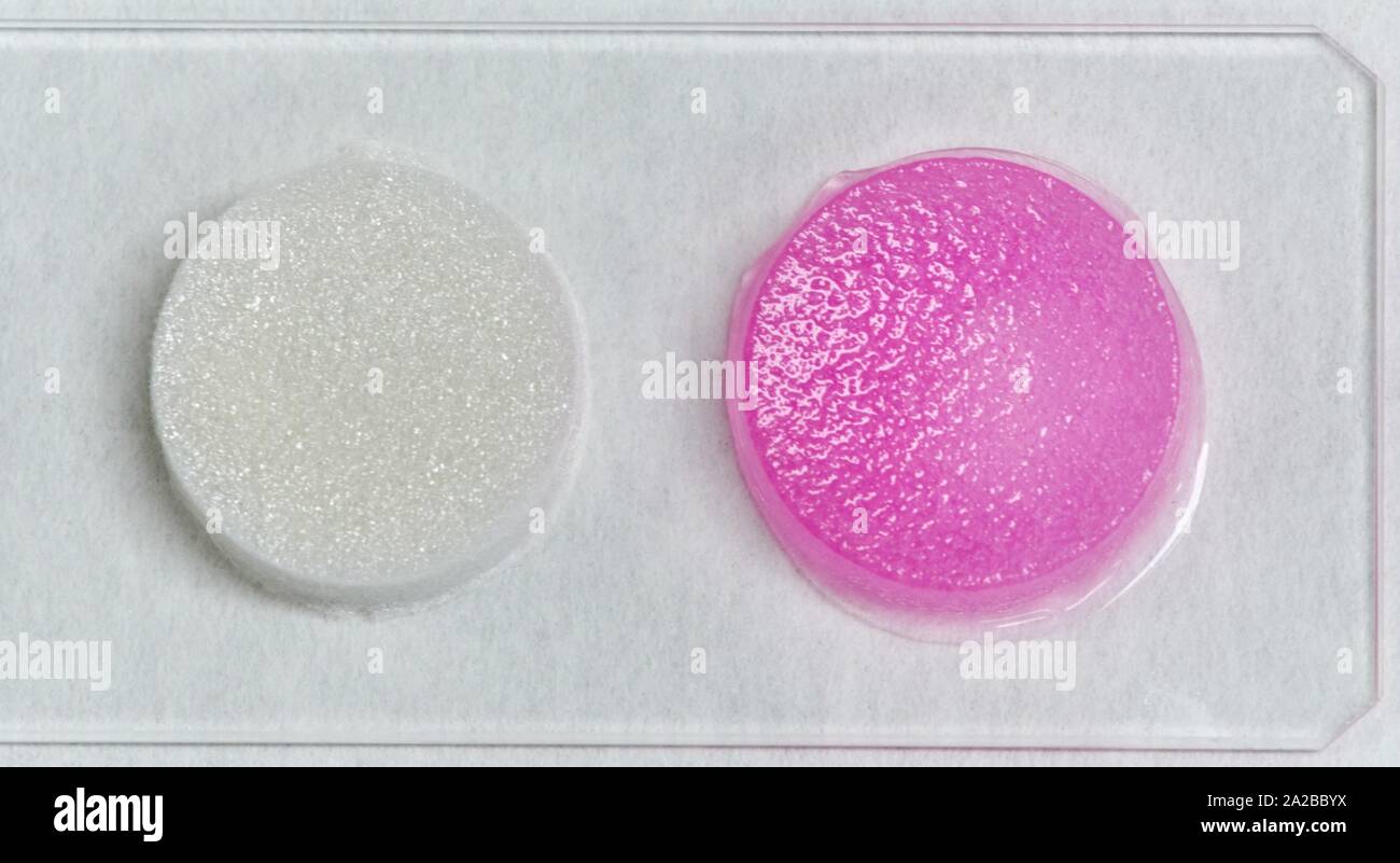 FATRIX, Decellularized regenerative matrix oriented to the treatment of ...