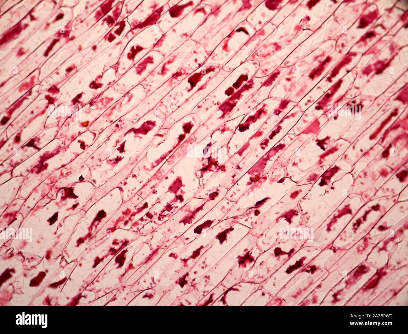 Pulp tissue hi-res stock photography and images - Alamy