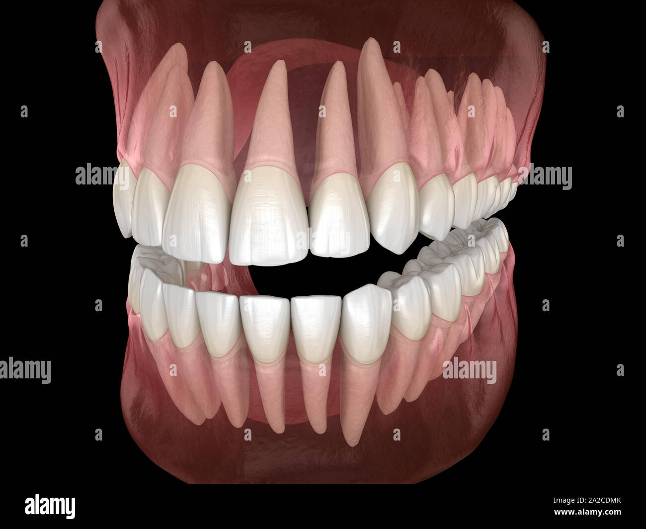 Morphology of mandibular and maxillary human gum and teeth. Medically ...