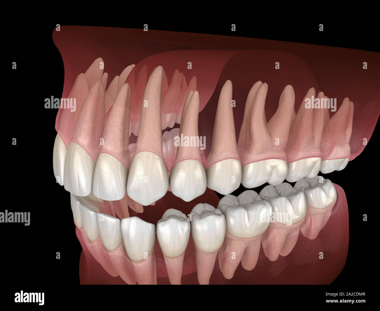 Morphology of mandibular and maxillary human gum and teeth. Medically ...