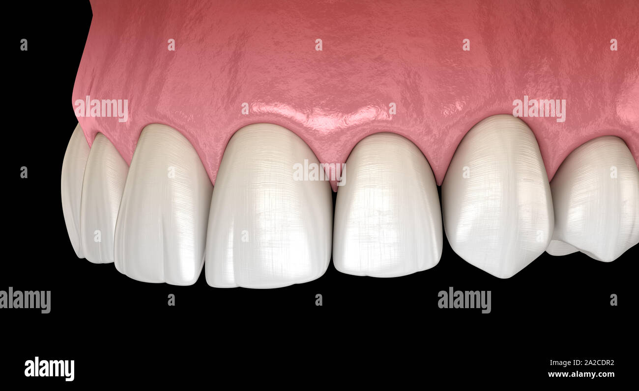 Maxillary human gum and teeth. Medically accurate tooth 3D illustration ...