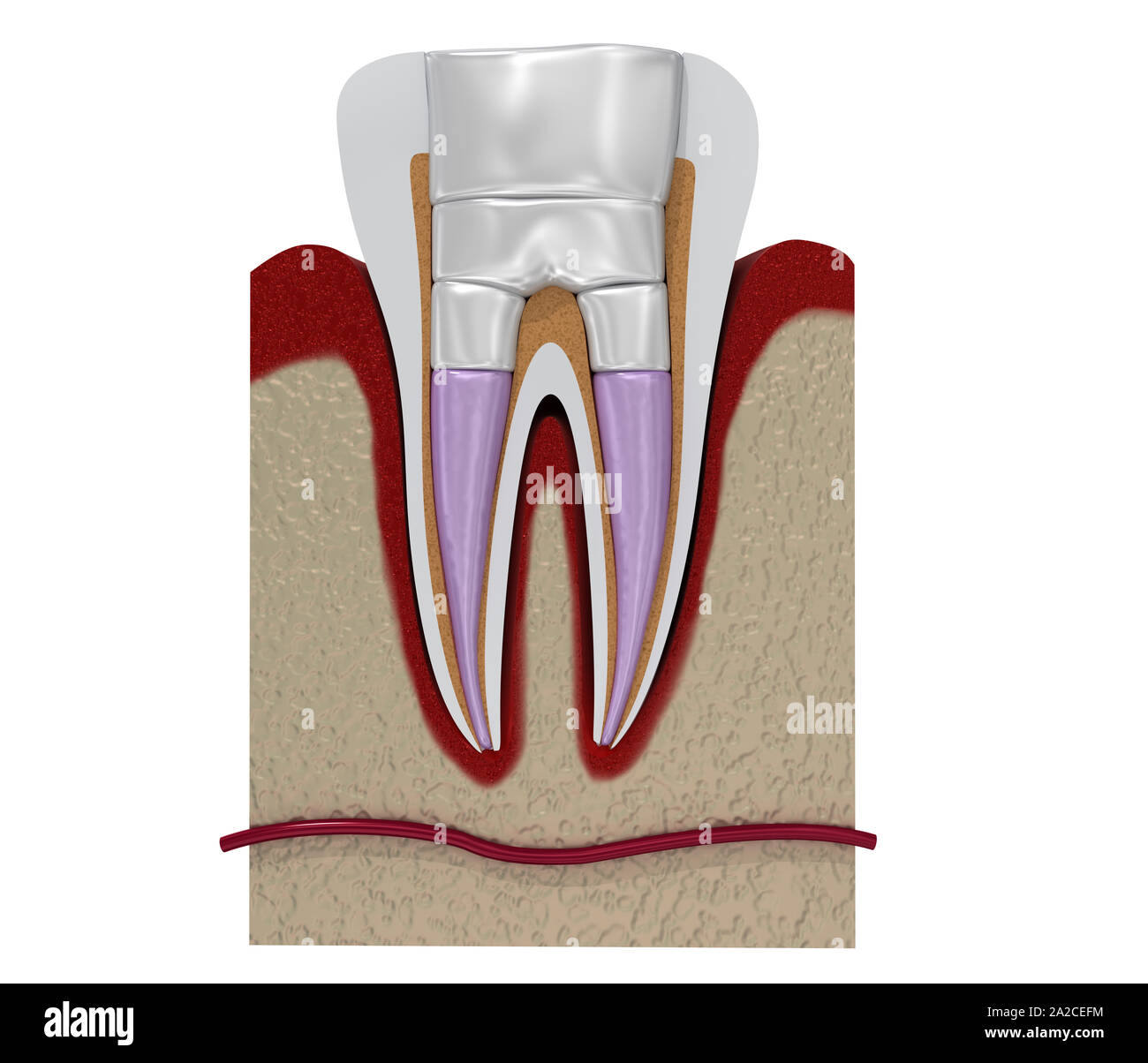 Dental fillings procedure diagramm . 3D illustration Stock Photo - Alamy