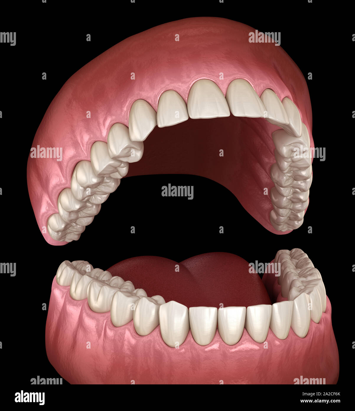 Dental anatomy - Opened Dentures. Medically accurate dental 3D ...