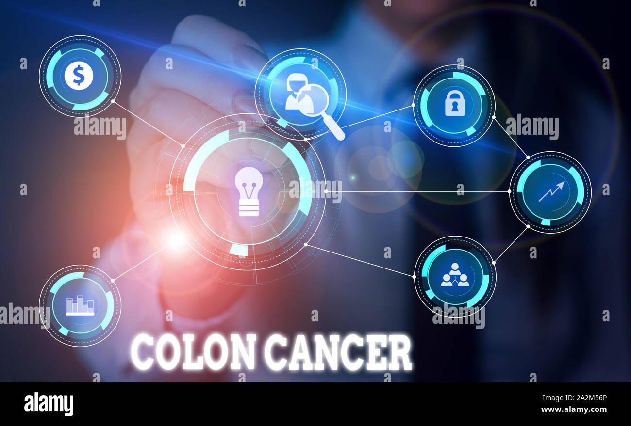 Handwriting text writing Colon Cancer. Conceptual photo the development ...