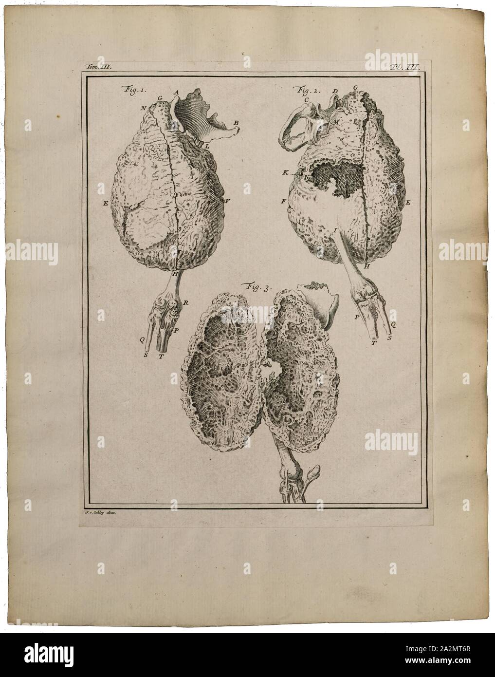 Homo sapiens, Print, Homo sapiens is the only extant human species. The ...