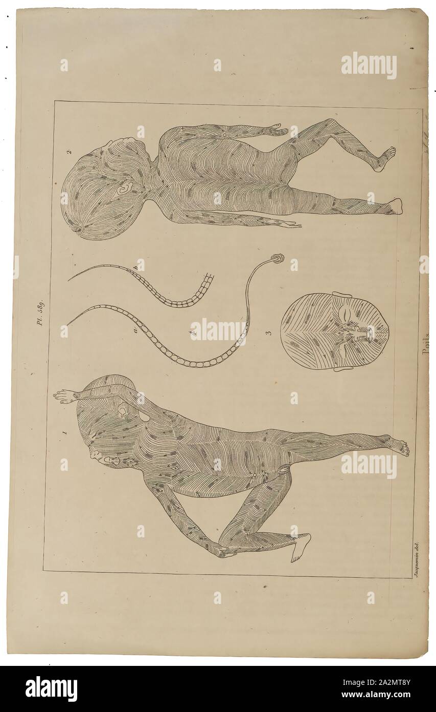 Homo sapiens, Print, Homo sapiens is the only extant human species. The ...