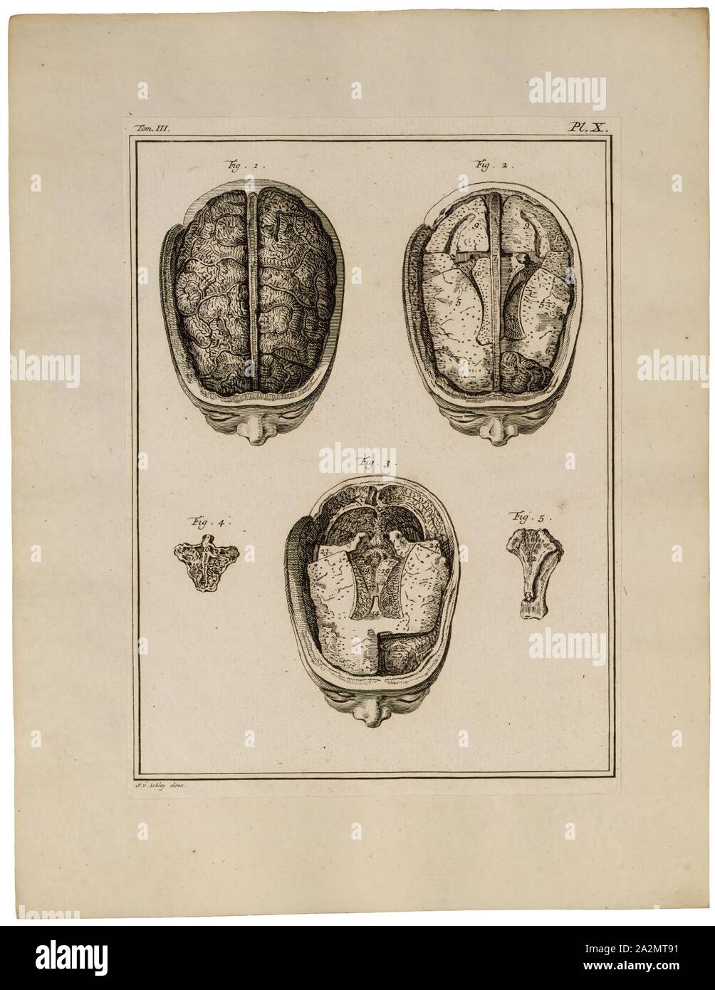 Homo sapiens, Print, Homo sapiens is the only extant human species. The ...