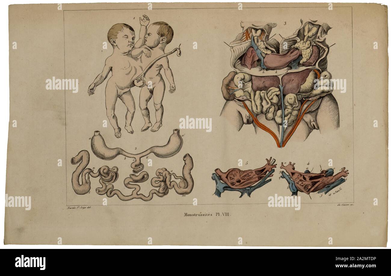 Homo sapiens, Print, Homo sapiens is the only extant human species. The ...