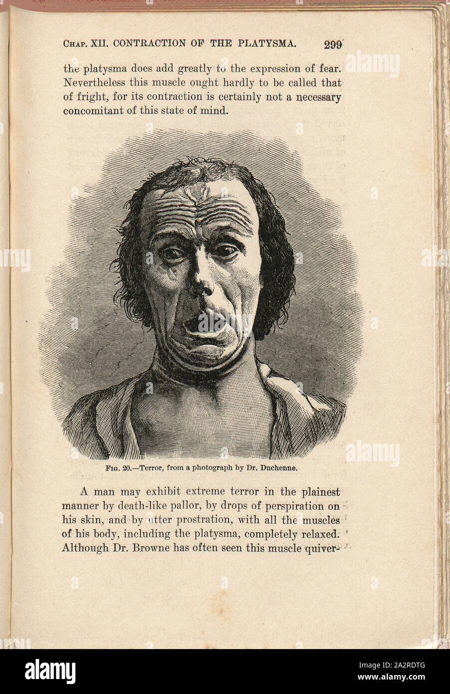 Terror, from a photograph by Dr. Duchenne, Expression of Dread, Fig. 20 ...