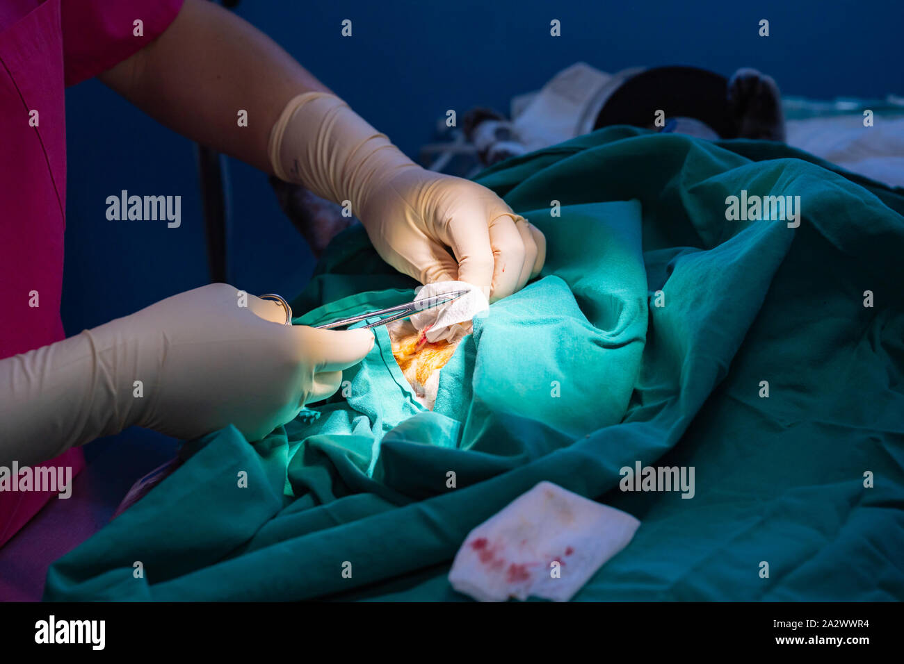 Orchiectomy Results