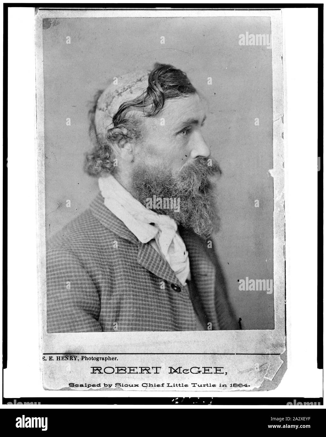Robert McGee, scalped by Sioux Chief Little Turtle in 1864 / E.E. Henry ...