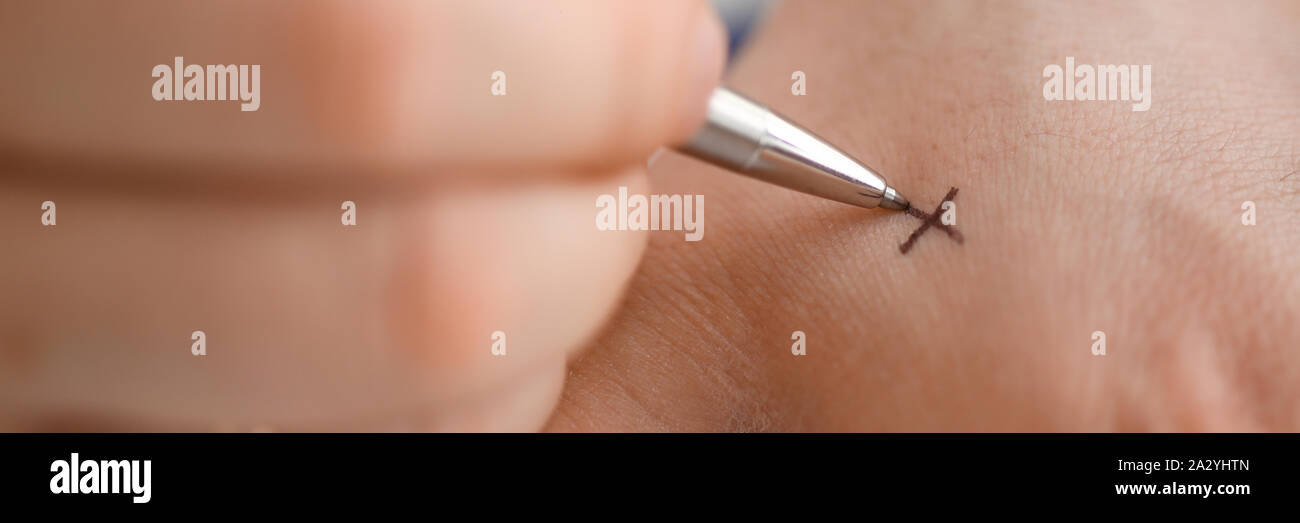 Male make x cross note with silver pen at his arm Stock Photo - Alamy