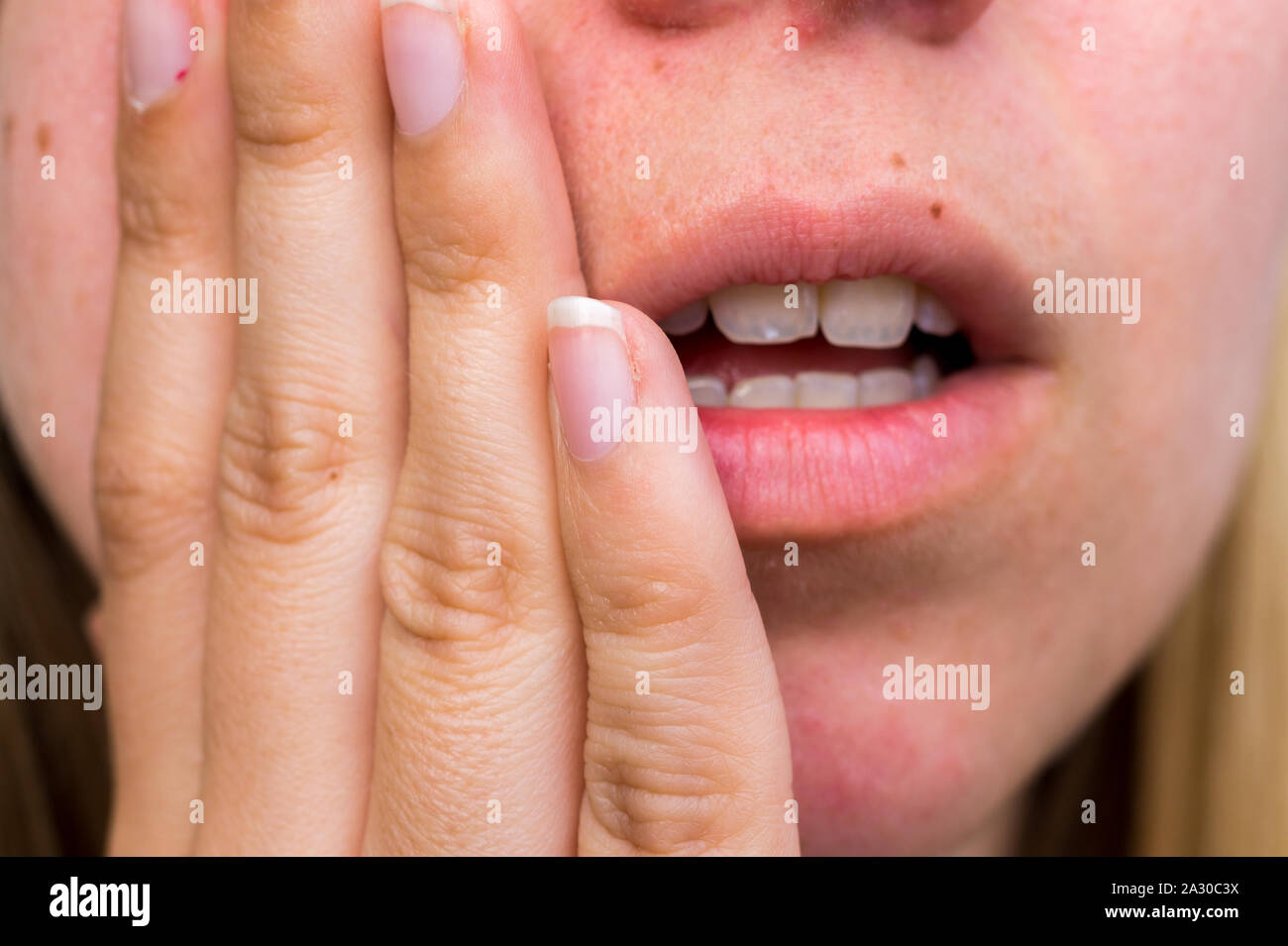 Woman has a toothache Stock Photo - Alamy