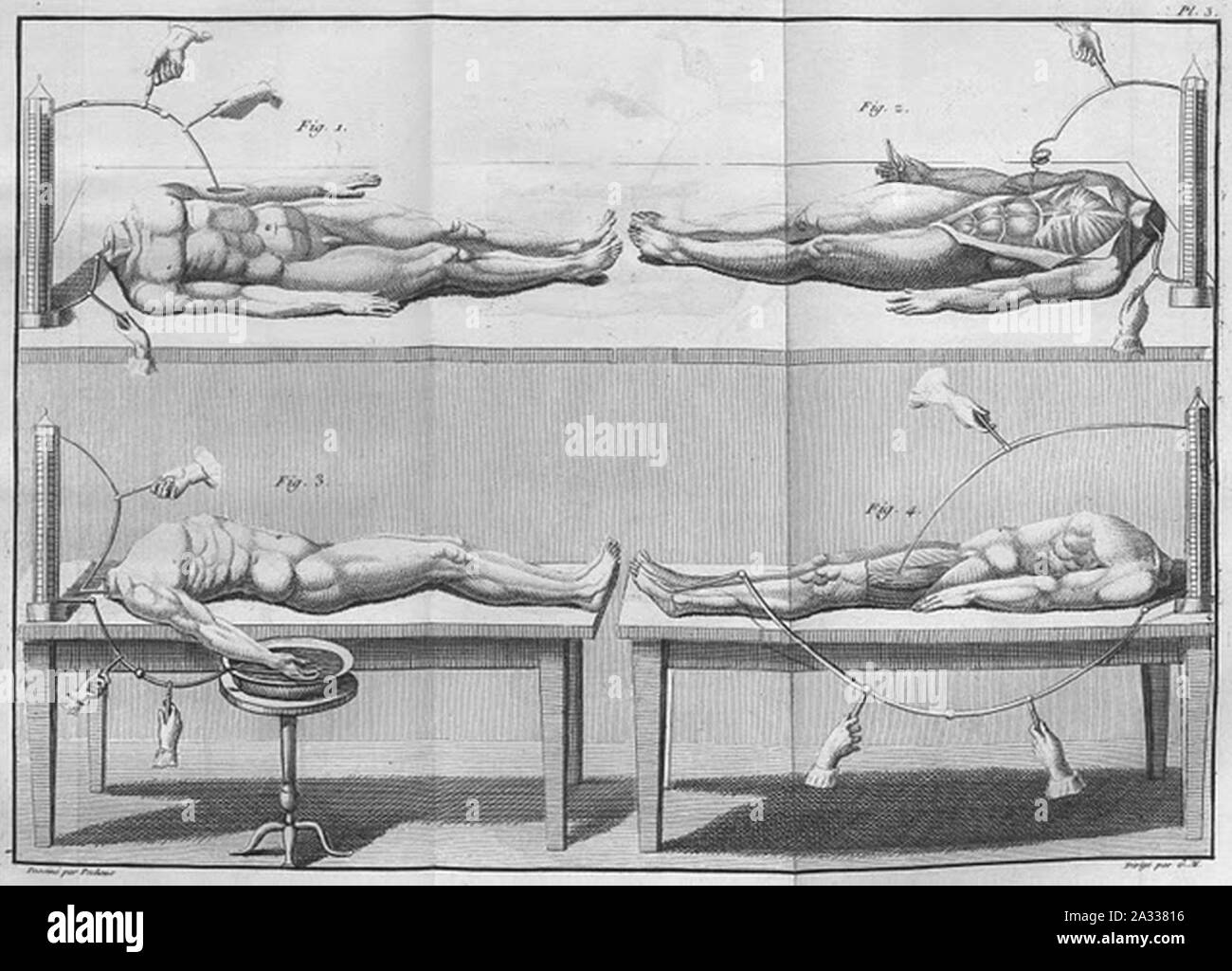 Experiments with headless cadavers Essai th orique et exp rimental sur ...