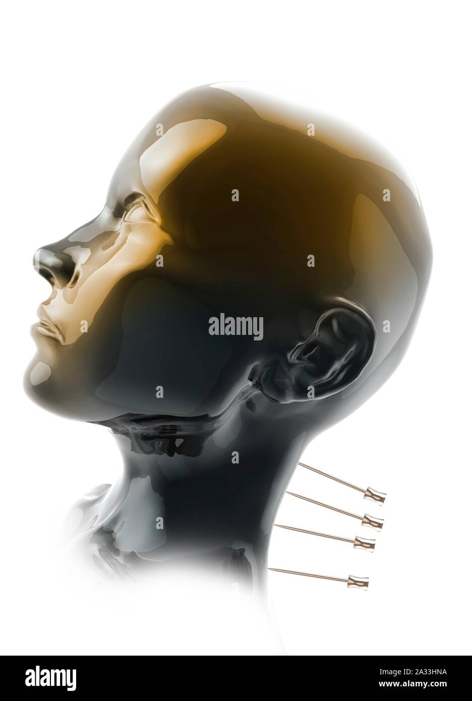 Acupuncture in human neck, illustration Stock Photo - Alamy