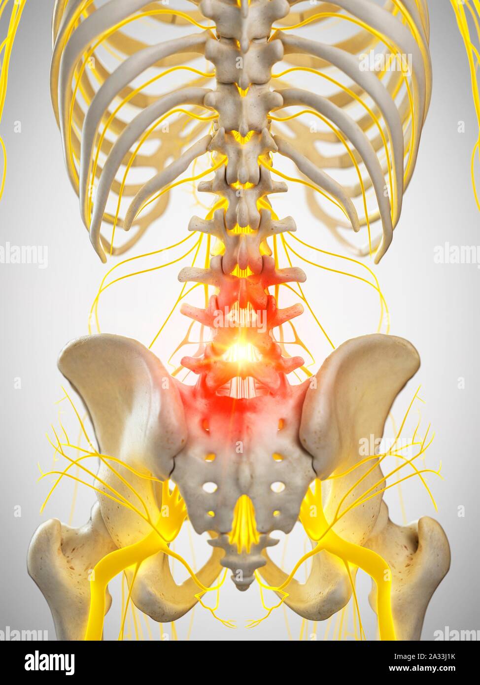 Back pain, conceptual illustration Stock Photo - Alamy