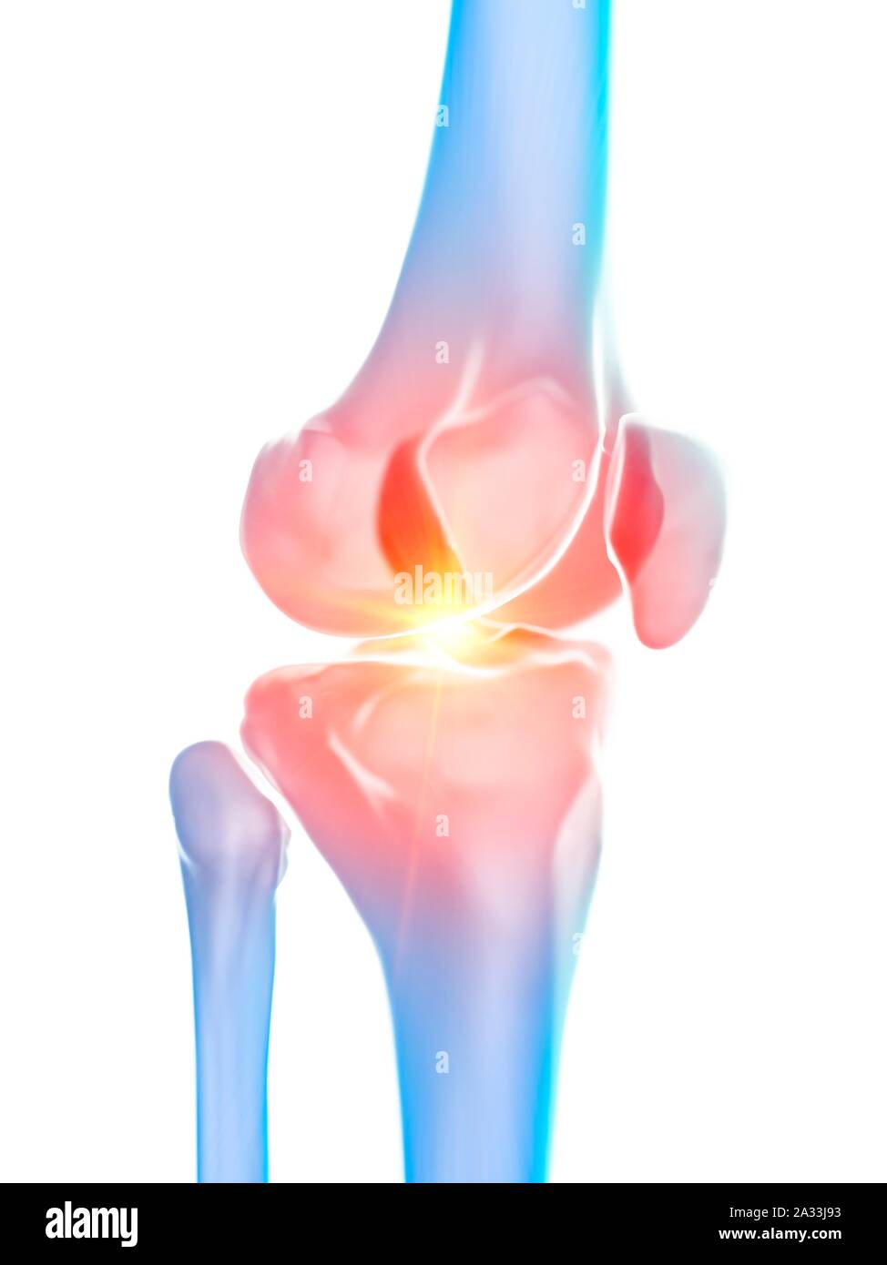 Knee pain, conceptual illustration Stock Photo - Alamy