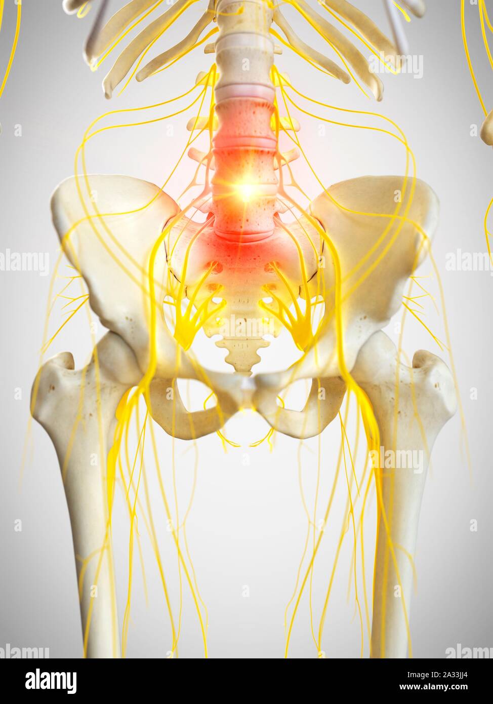 Pelvic pain, conceptual illustration Stock Photo - Alamy