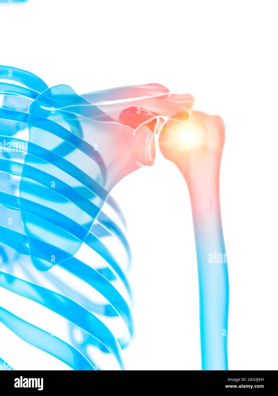 Shoulder pain, conceptual illustration Stock Photo - Alamy Shoulder pain, conceptual illustration Stock Photo - Alamy