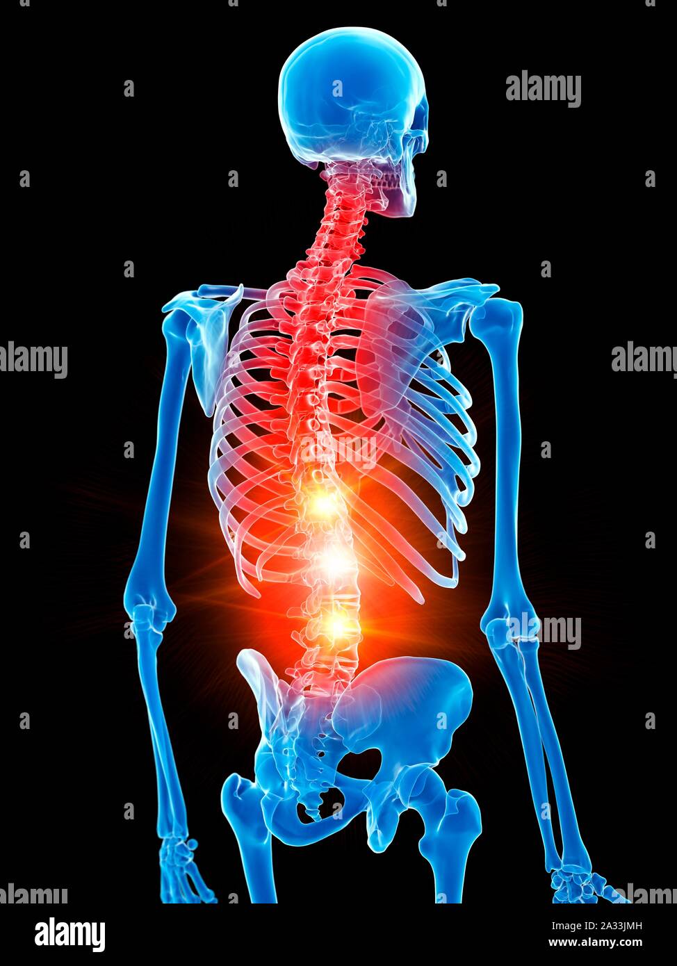 Thorax pain, conceptual illustration Stock Photo - Alamy