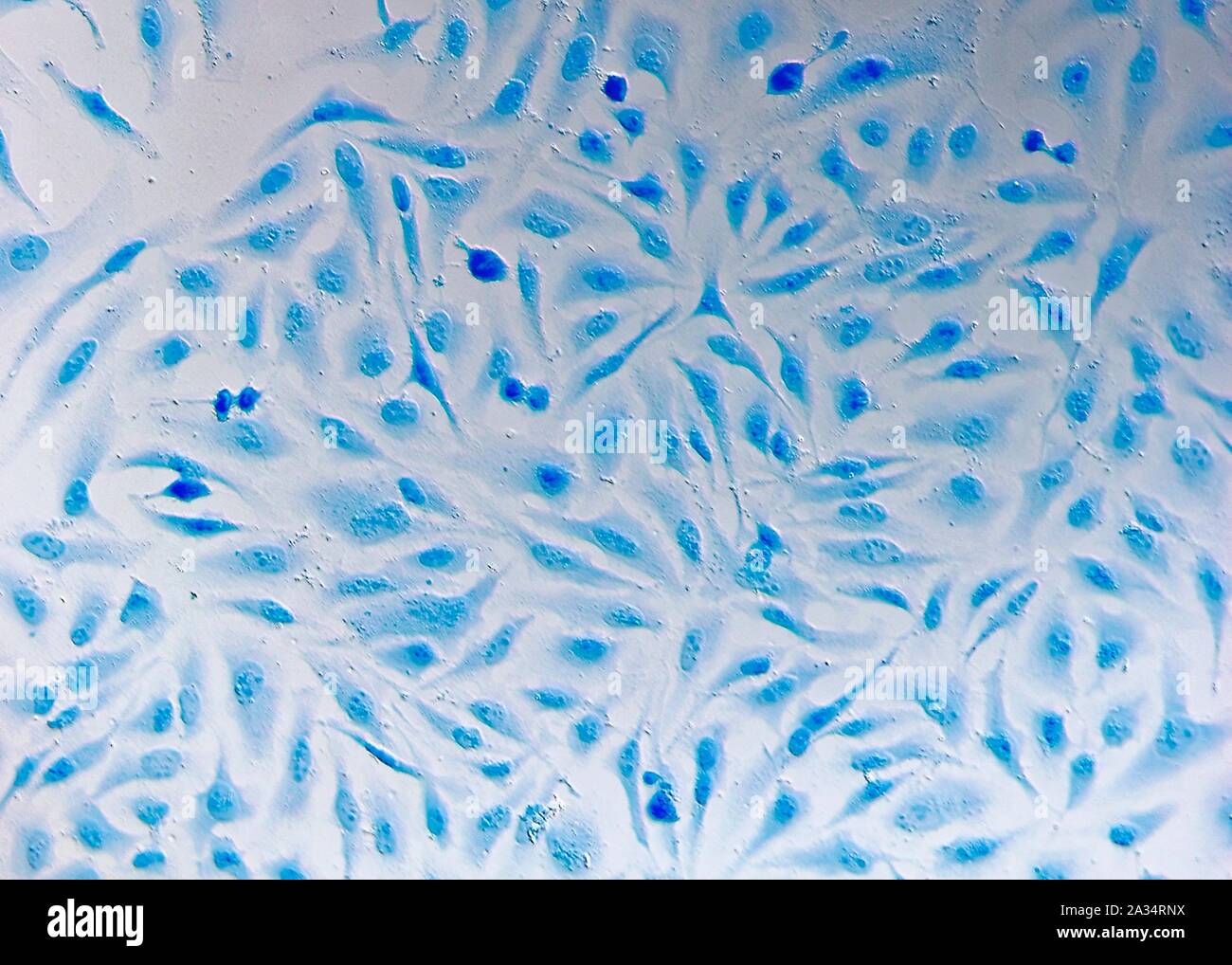 HeLa cervical cancer cells, stained with Coomassie blue, under ...