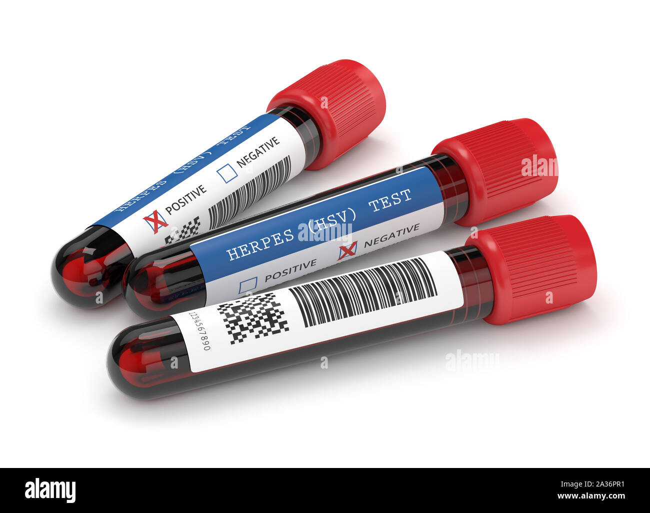 3d render of blood samples with herpes test over white background Stock ...