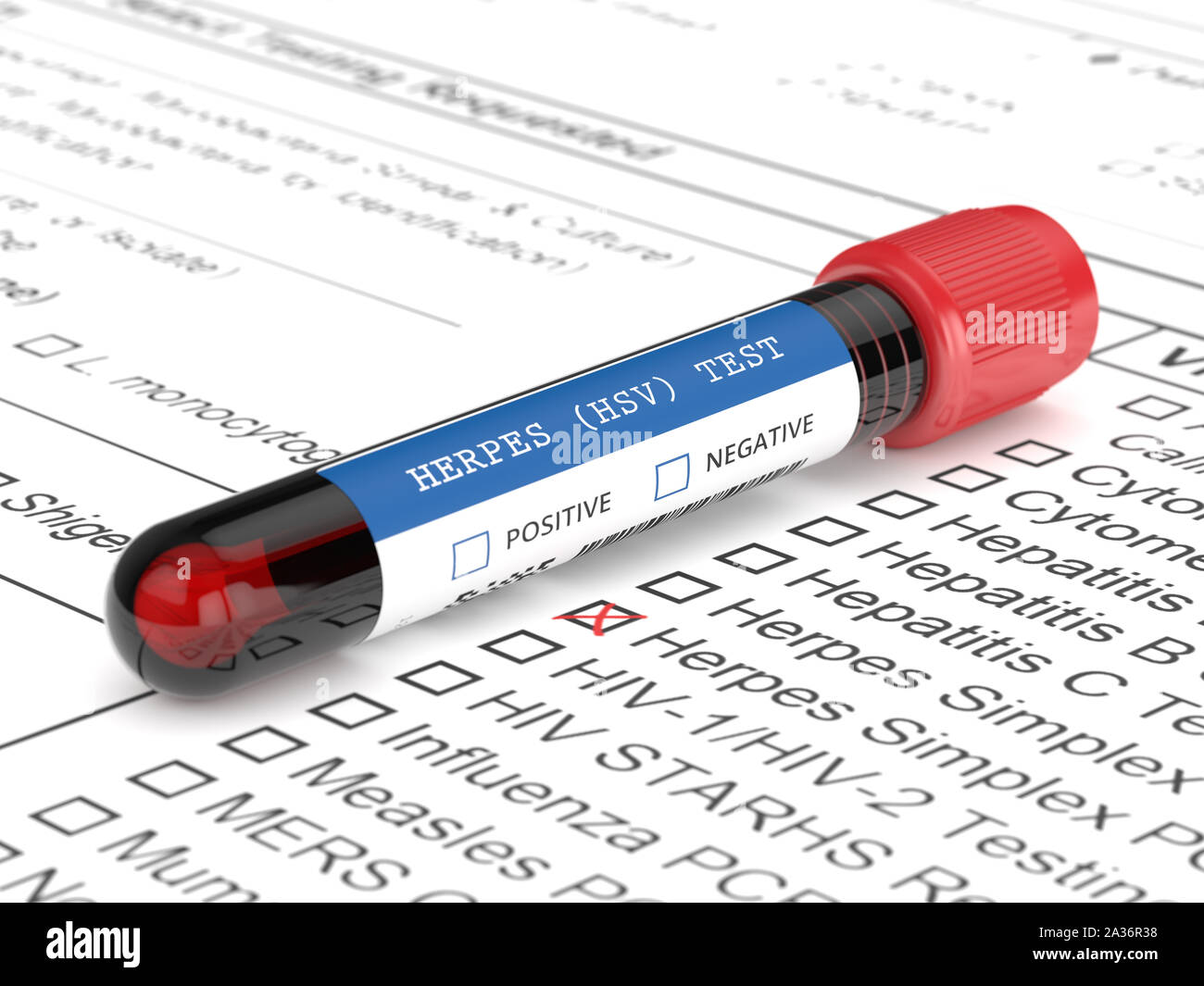 3d render of blood samples with herpes test lying on lab form Stock ...